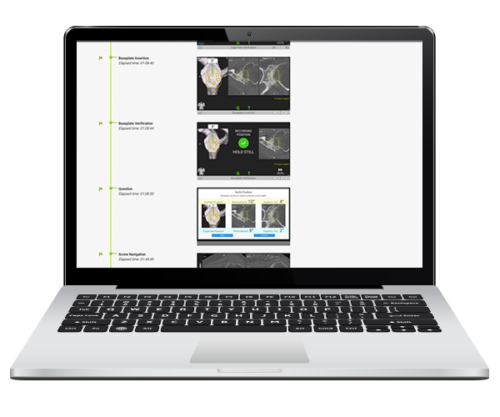 GPS Shoulder | Advita Ortho