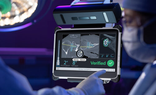 GPS Shoulder | Advita Ortho
